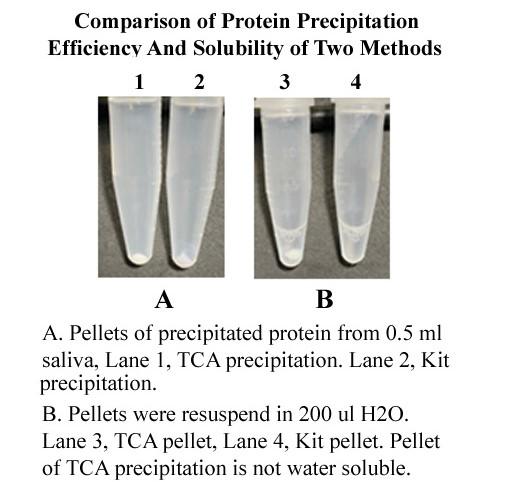 Minute Native Protein Precipitation Kit from Saliva – Invent ...